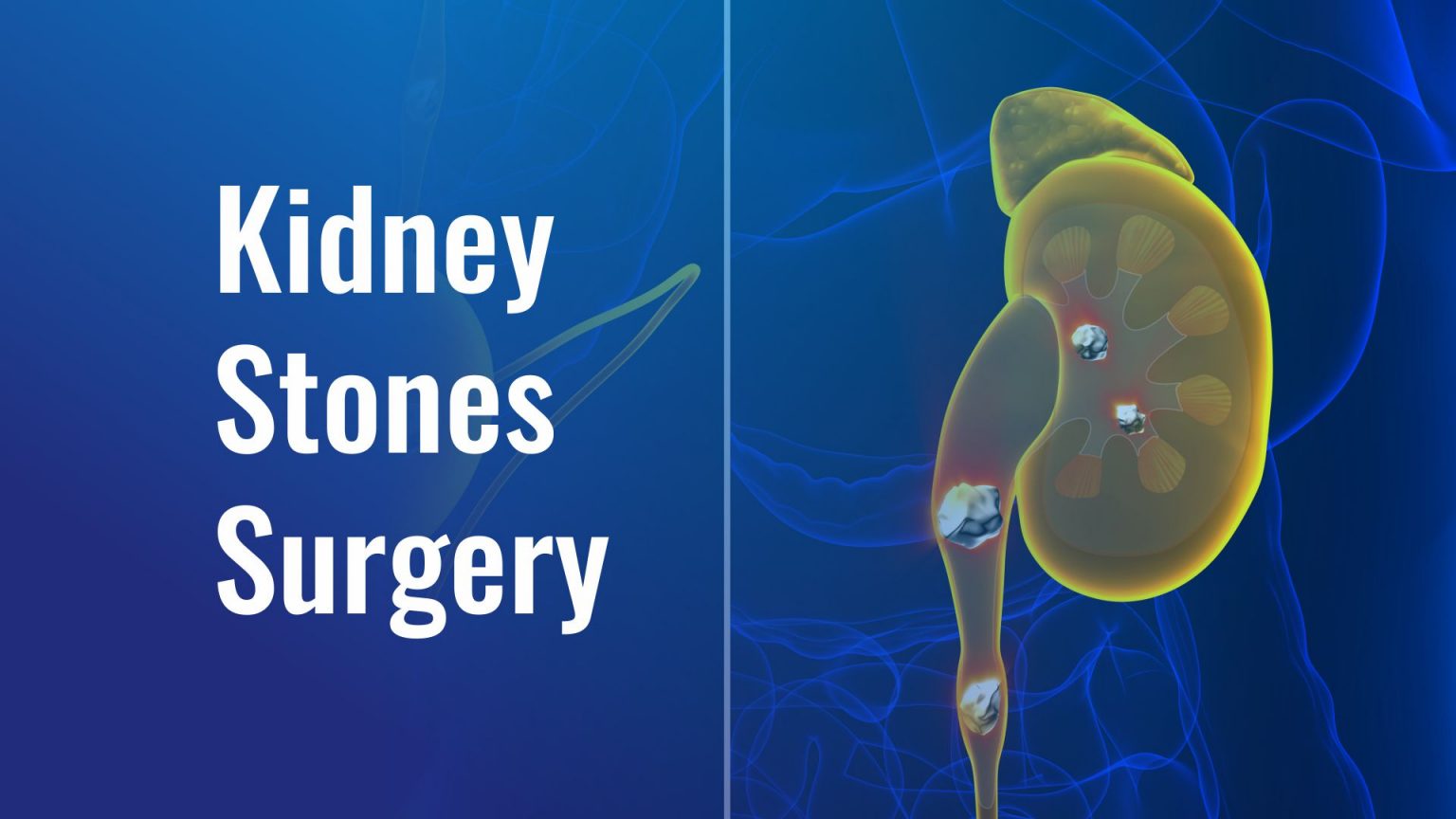 Kidney Stone Surgery – RIRS INDIA